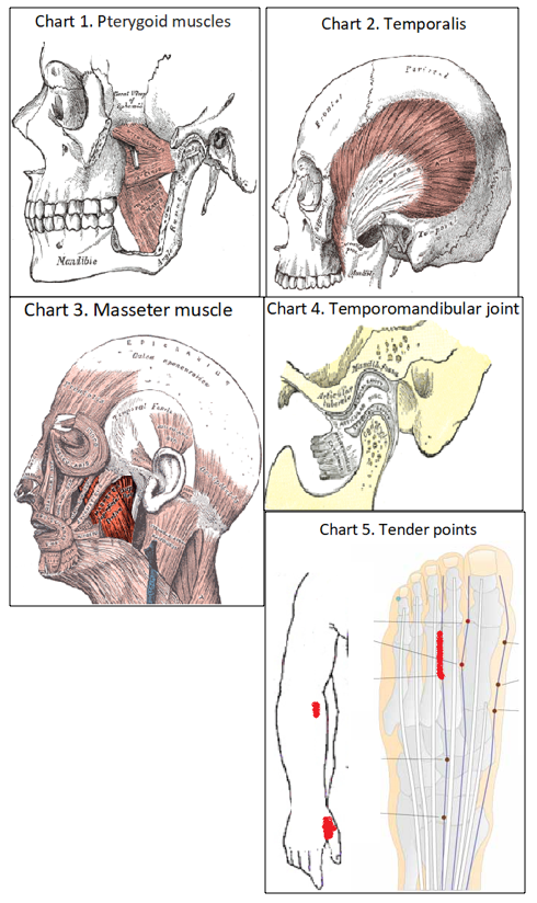 Temporomandibular Joint Dysfunction – Talented Hands Physical Therapy ...