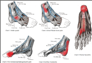 Ankle and Foot Pain – Talented Hands Physical Therapy & Acupuncture